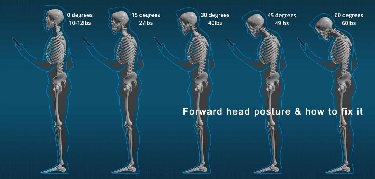 2 MOST COMMON Postural Problems (and FIXES!) – Massage Therapy on Elizabeth